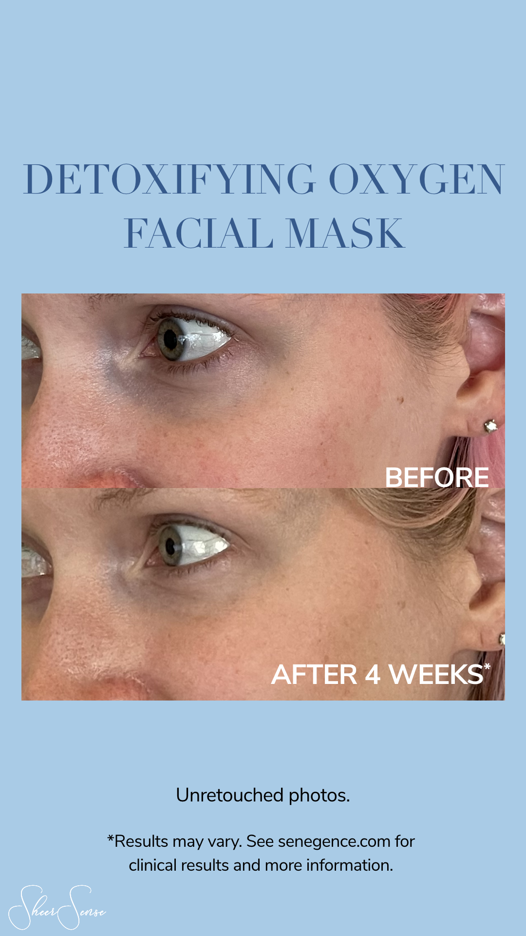 Detoxifying Oxygen Facial Mask